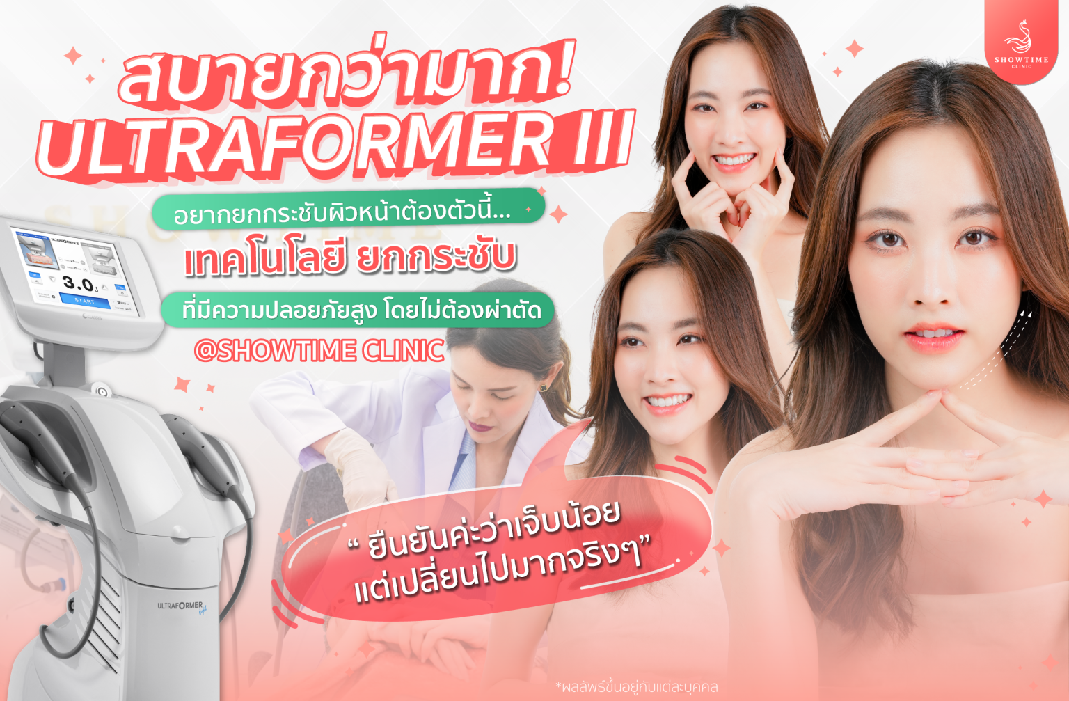Ultraformer III สบายกว่ามาก! คุณนุชยืนยัน! - showtimeclinic